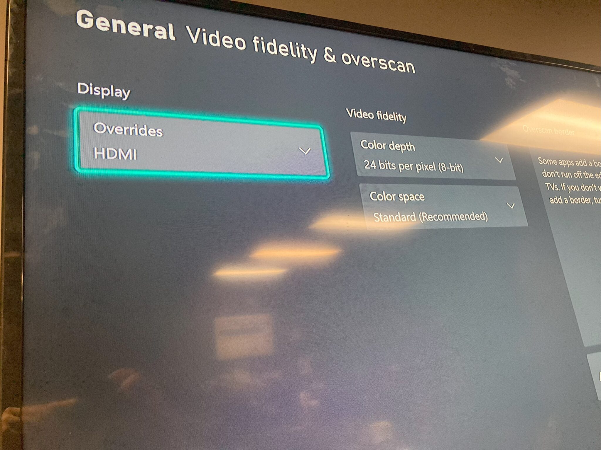 Xbox Series S ESD Chip Bypass U21 Chip - Black Screen Repair | Logistics